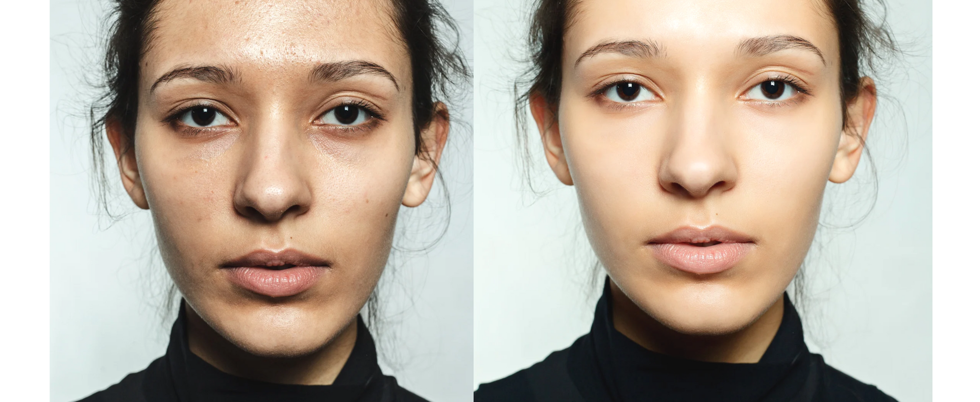 3-Step Night Routine for Effective Melasma Treatment at Home – Abera.us