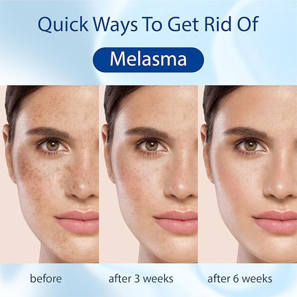 Independence Day SALE 50% - ABERA Retinol Serum to Reduce Wrinkles 20m – Abera.us